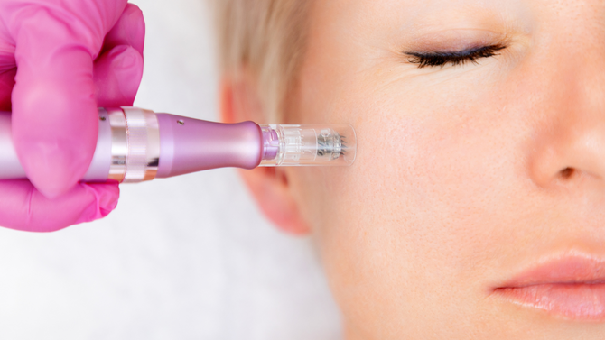 Contour Body Aesthetics | RF Microneedling in Glenwood Springs, CO